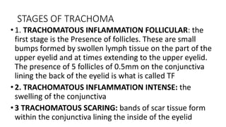 trachoma-paula.pptx | Eye and Vision Conditions | Diseases and Conditions