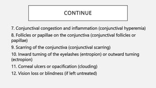 TRACHOMA and sign and symptoms cause medical management | PPT