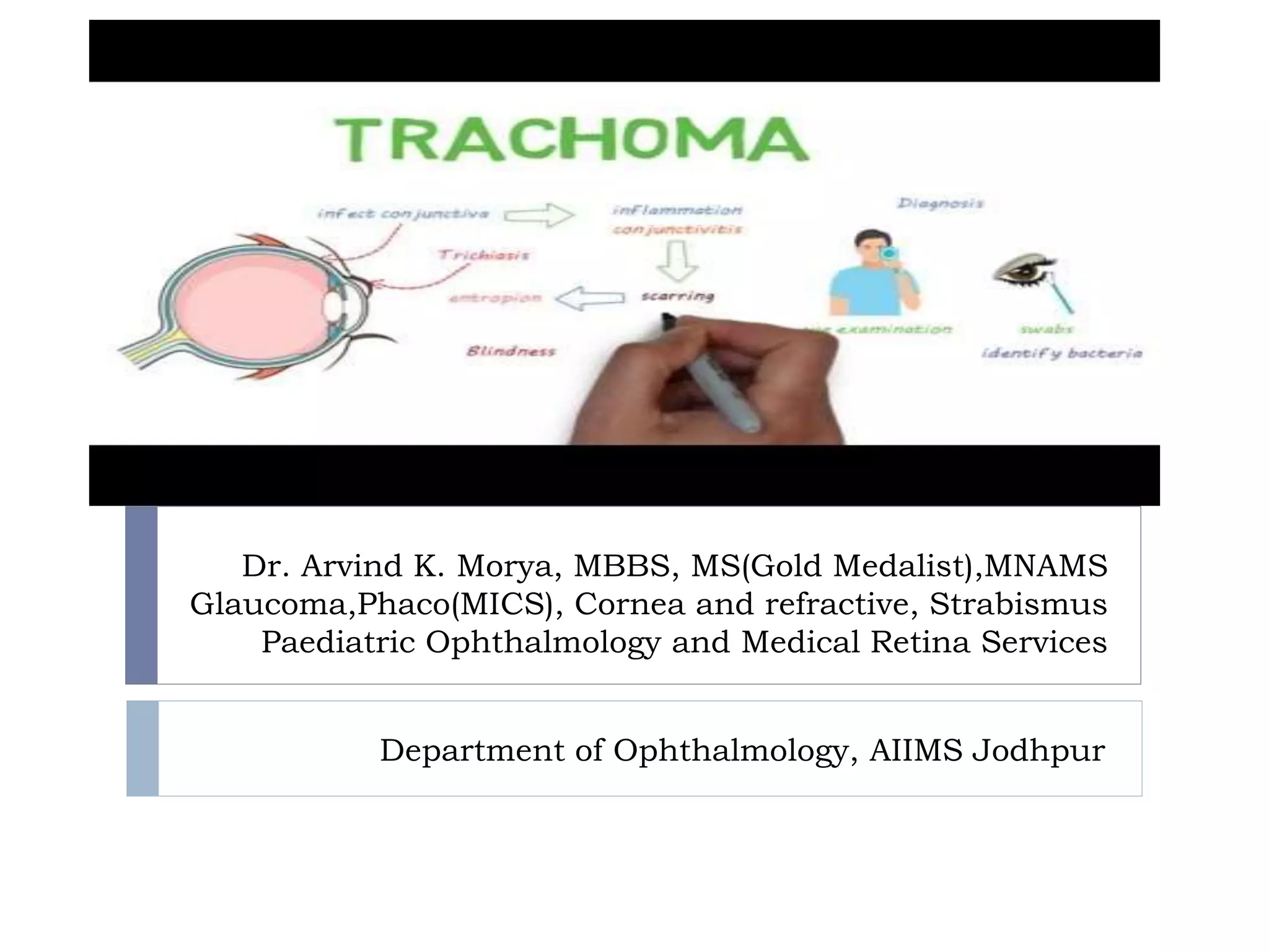TRACHOMA- DIAGNOSIS AND MANAGEMENT | PPT