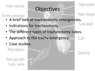 Trachy Emergencies | PPTX