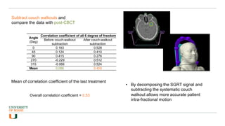 Tracking Intrafractional Motion for Linac-based SRS with SGRT and ...