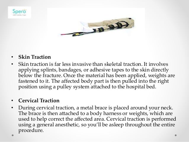 Skin Vs Skeletal Traction