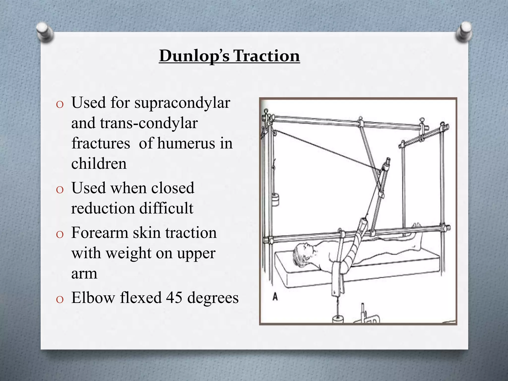 Traction in orthopaedics | PPTX