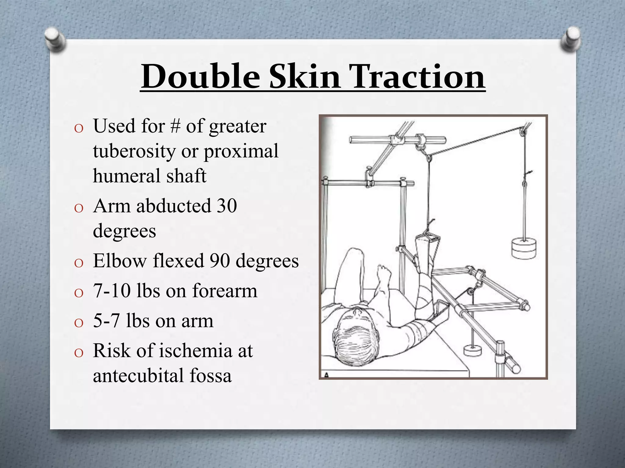 Traction in orthopaedics | PPTX