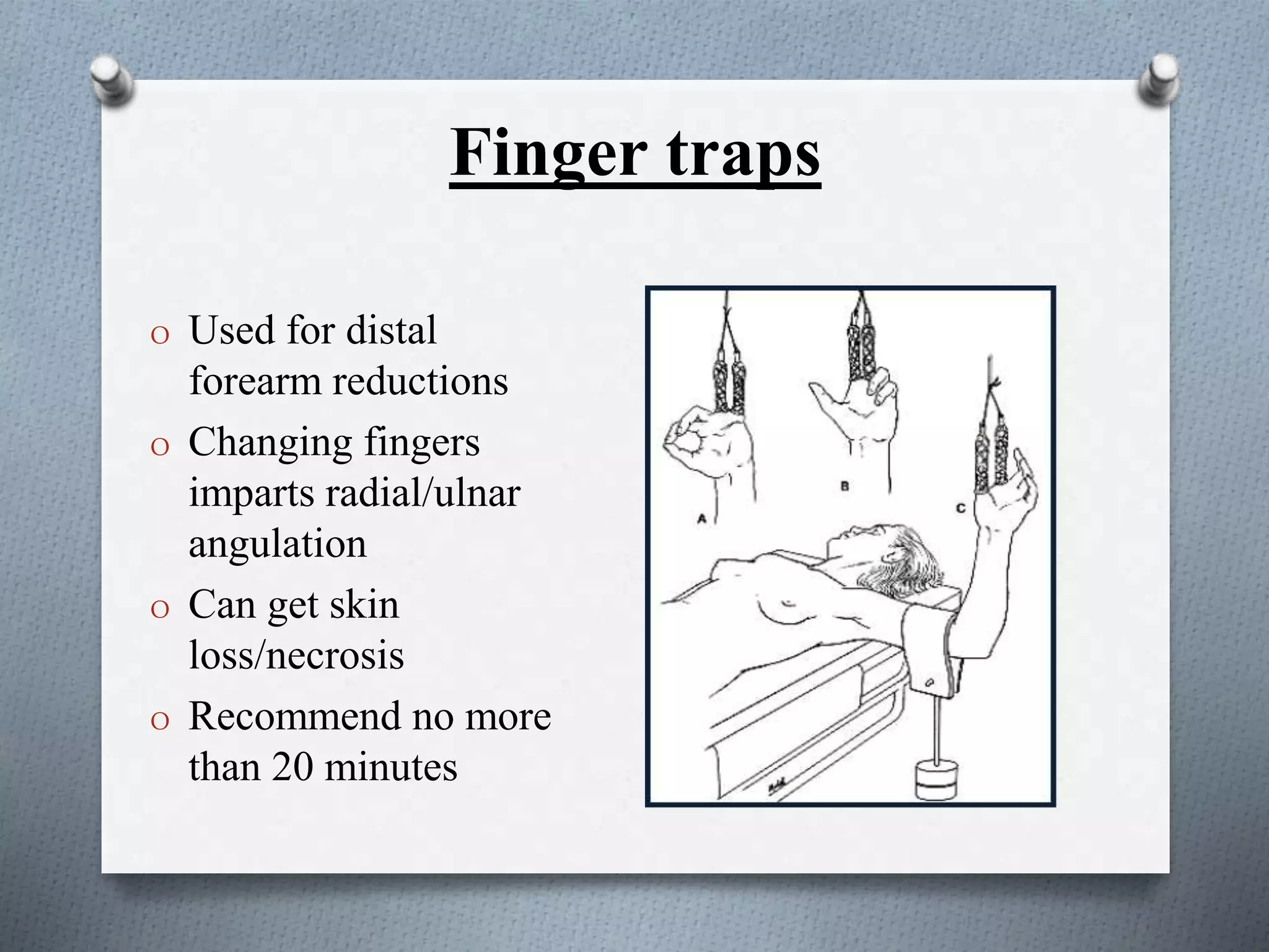 Traction in orthopaedics | PPTX