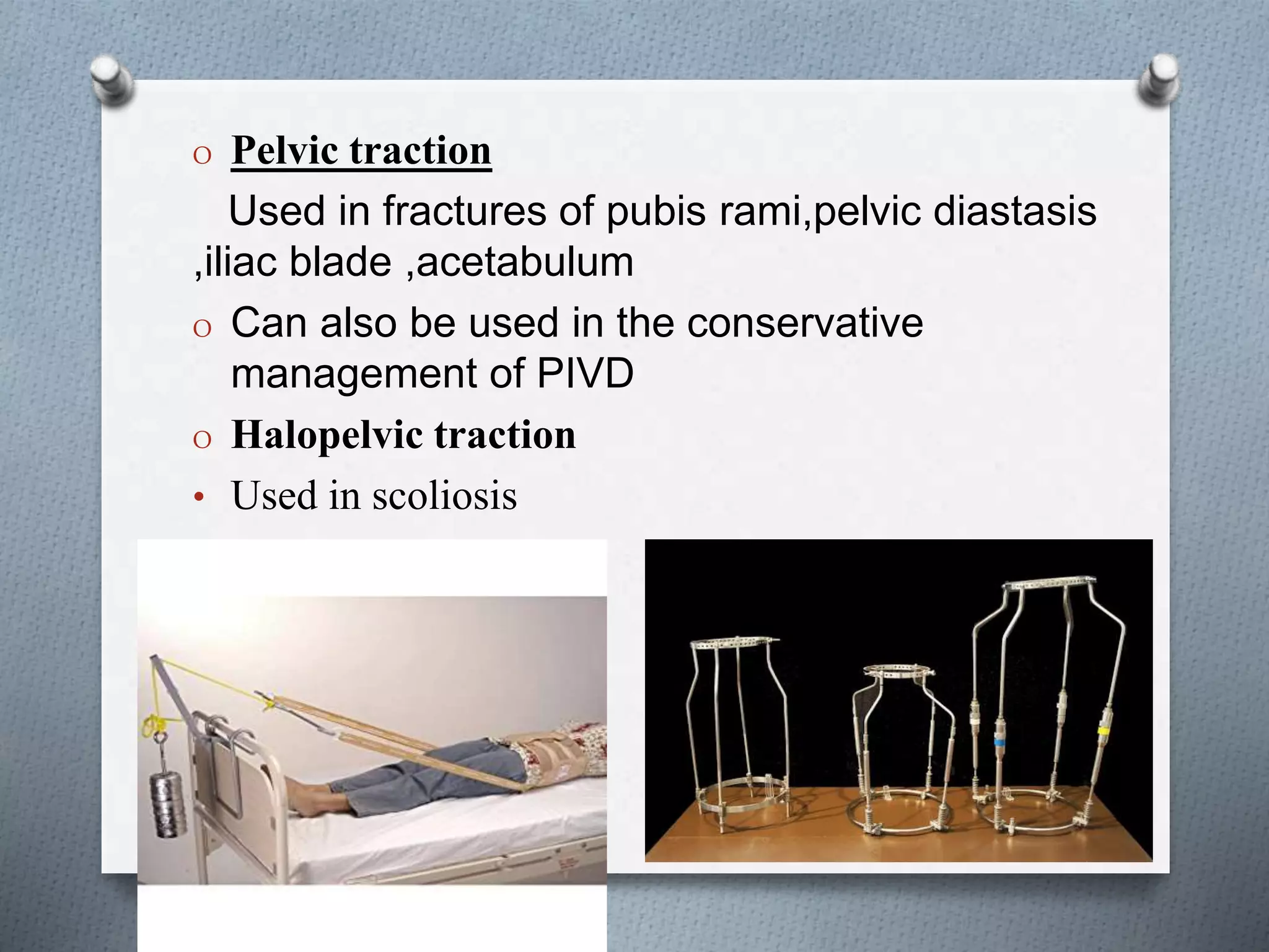 Traction in orthopaedics | PPTX