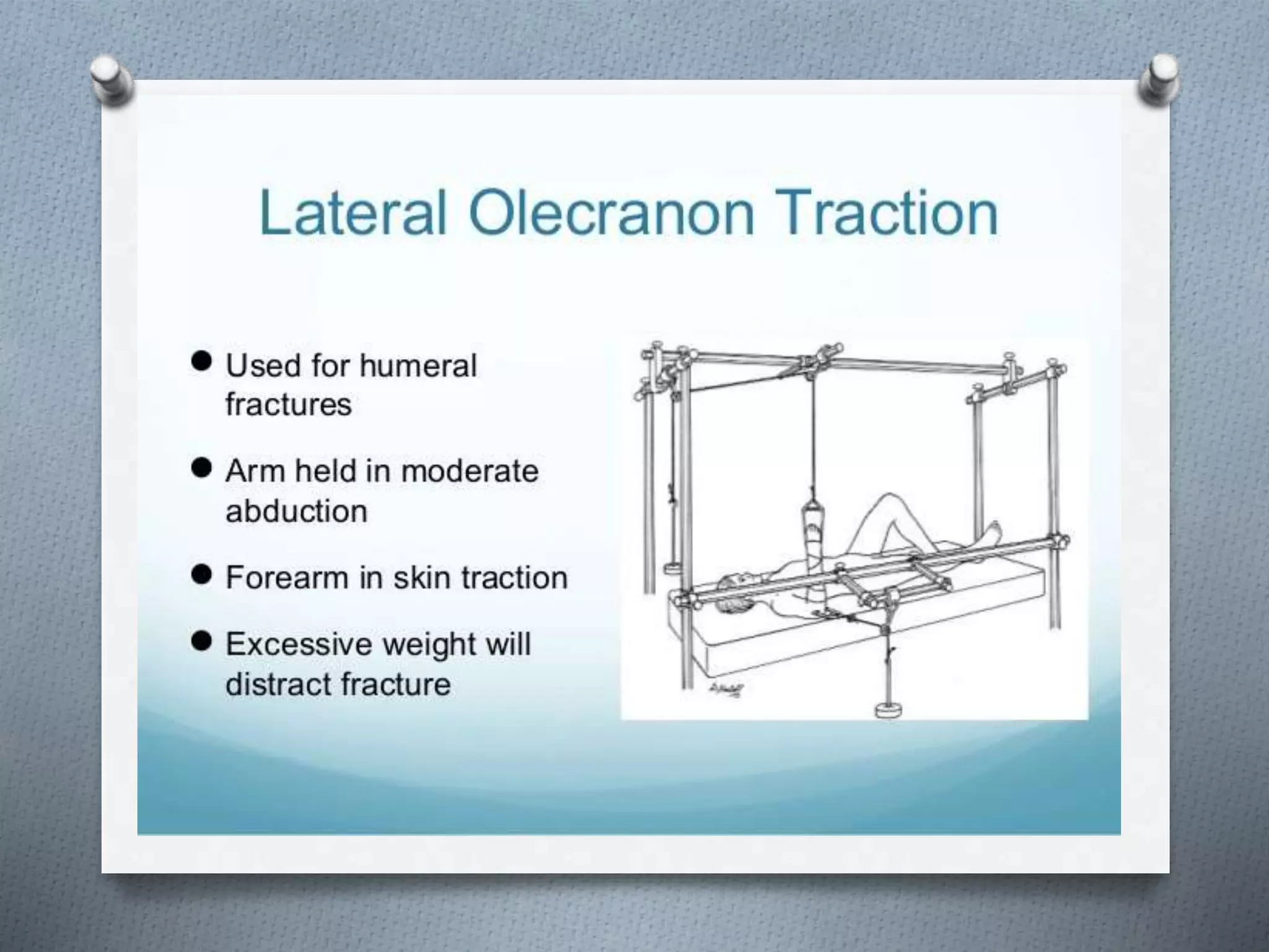 Traction in orthopaedics | PPTX