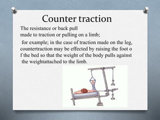 Traction in orthopaedics | PPTX