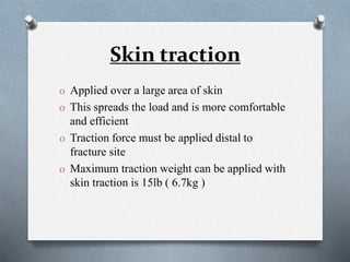Traction in orthopaedics | PPTX