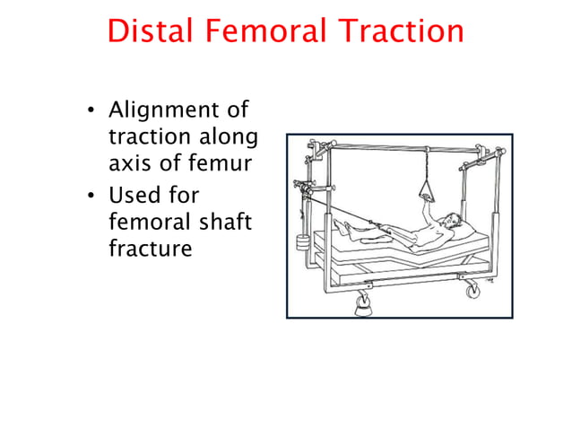 Traction in Orthopaedic | PPT