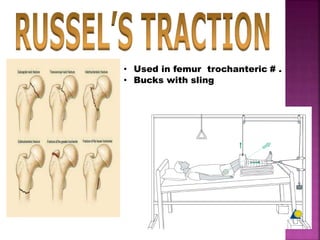 Russells Traction