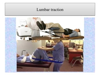 Manual Lumbar Traction Techniques