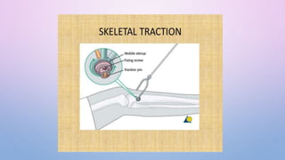 Traction | PPTX