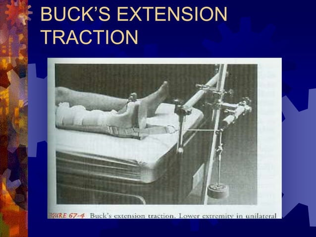 Traction | PPT