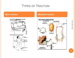 Traction.ppt