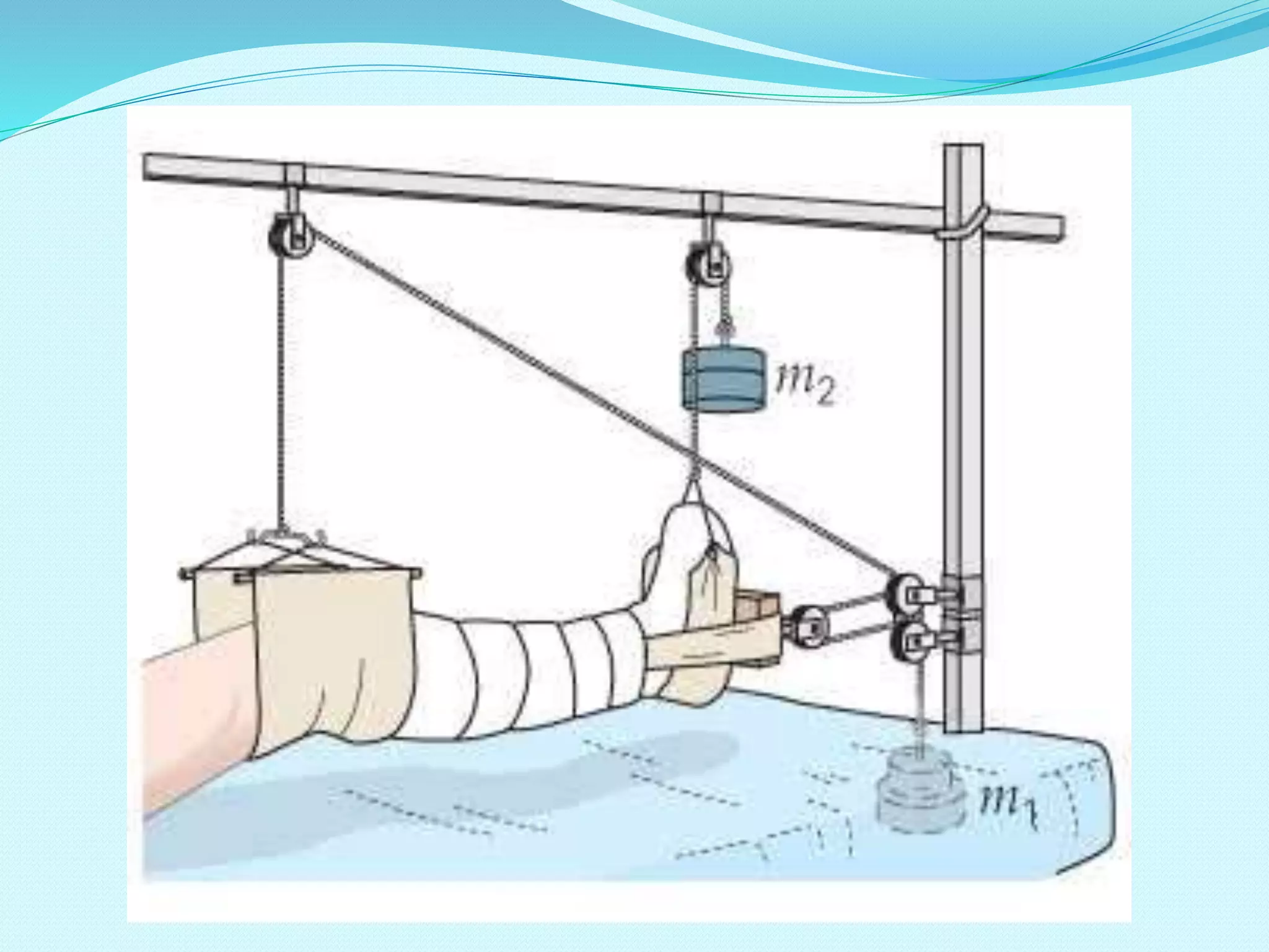 TRACTION for nursing students | PPTX