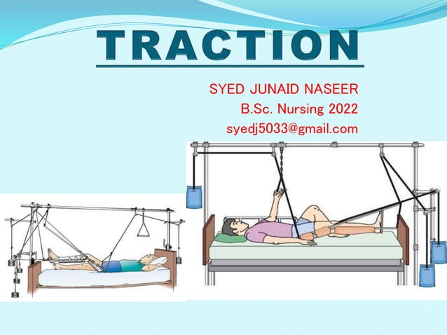 TRACTION for nursing students | PPTX | First Aid | Injuries