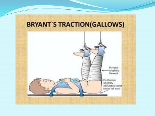 TRACTION for nursing students | PPTX | First Aid | Injuries