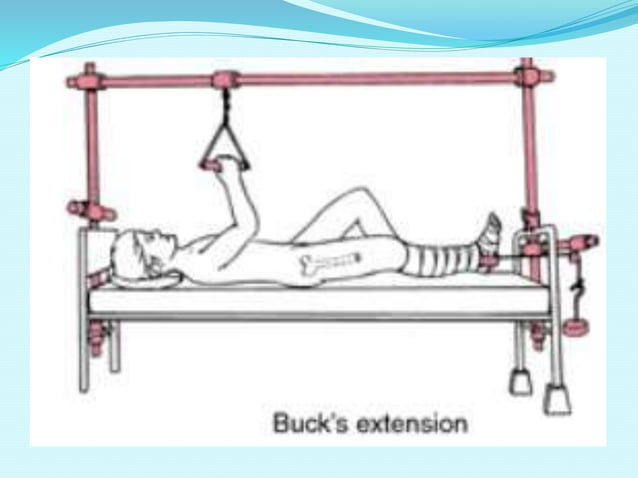 TRACTION for nursing students | PPTX | First Aid | Injuries