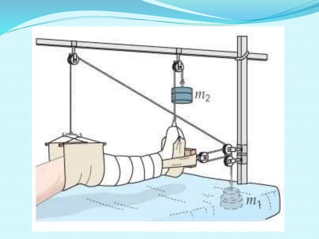 TRACTION for nursing students | PPTX | First Aid | Injuries