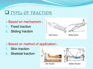 TRACTION for nursing students | PPTX | First Aid | Injuries