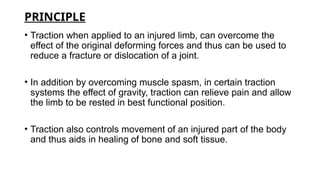 Traction used in orthopedics and practice | PPTX