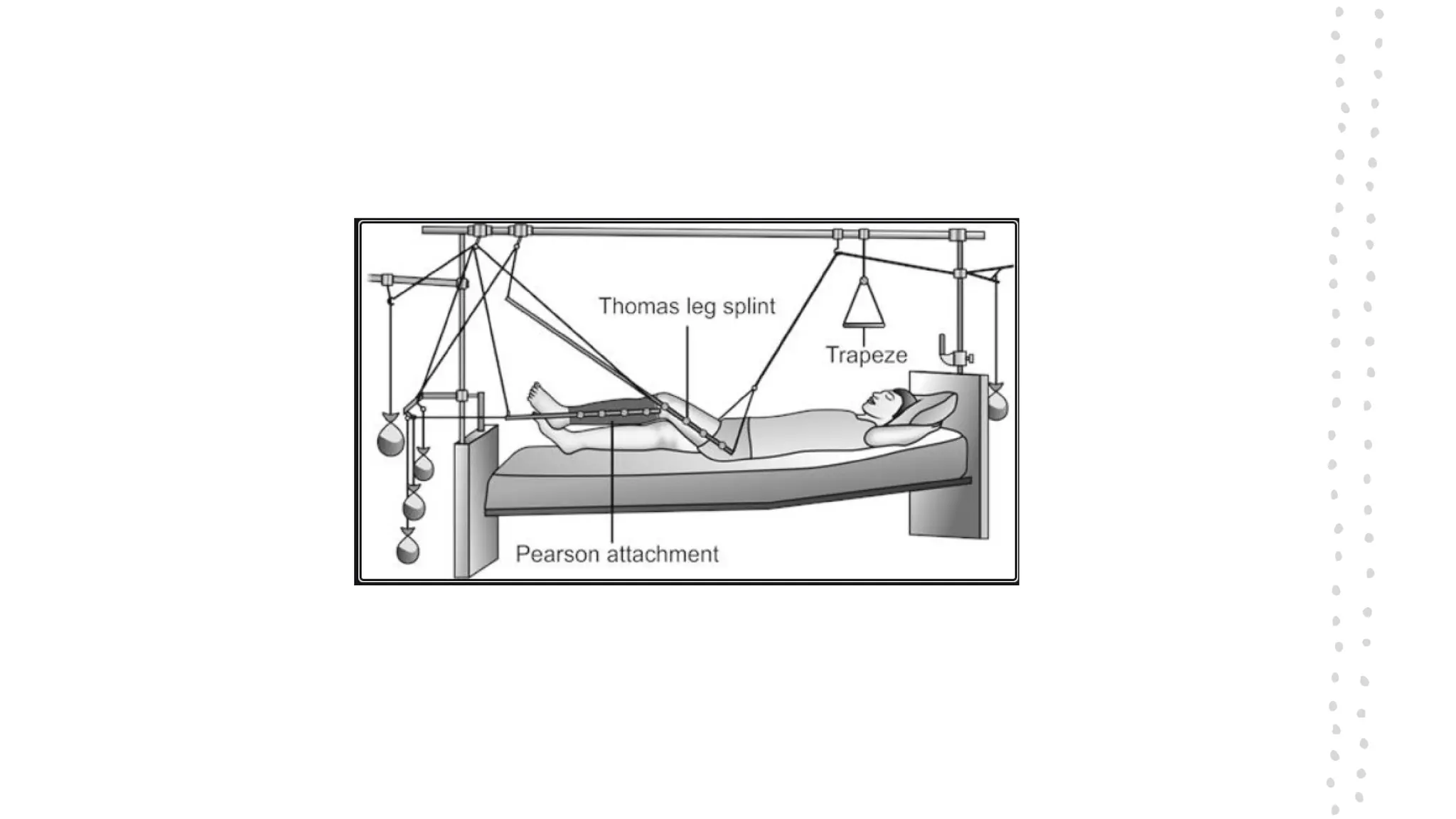 TRACTION.pptx orthopedics lecture series | PPT