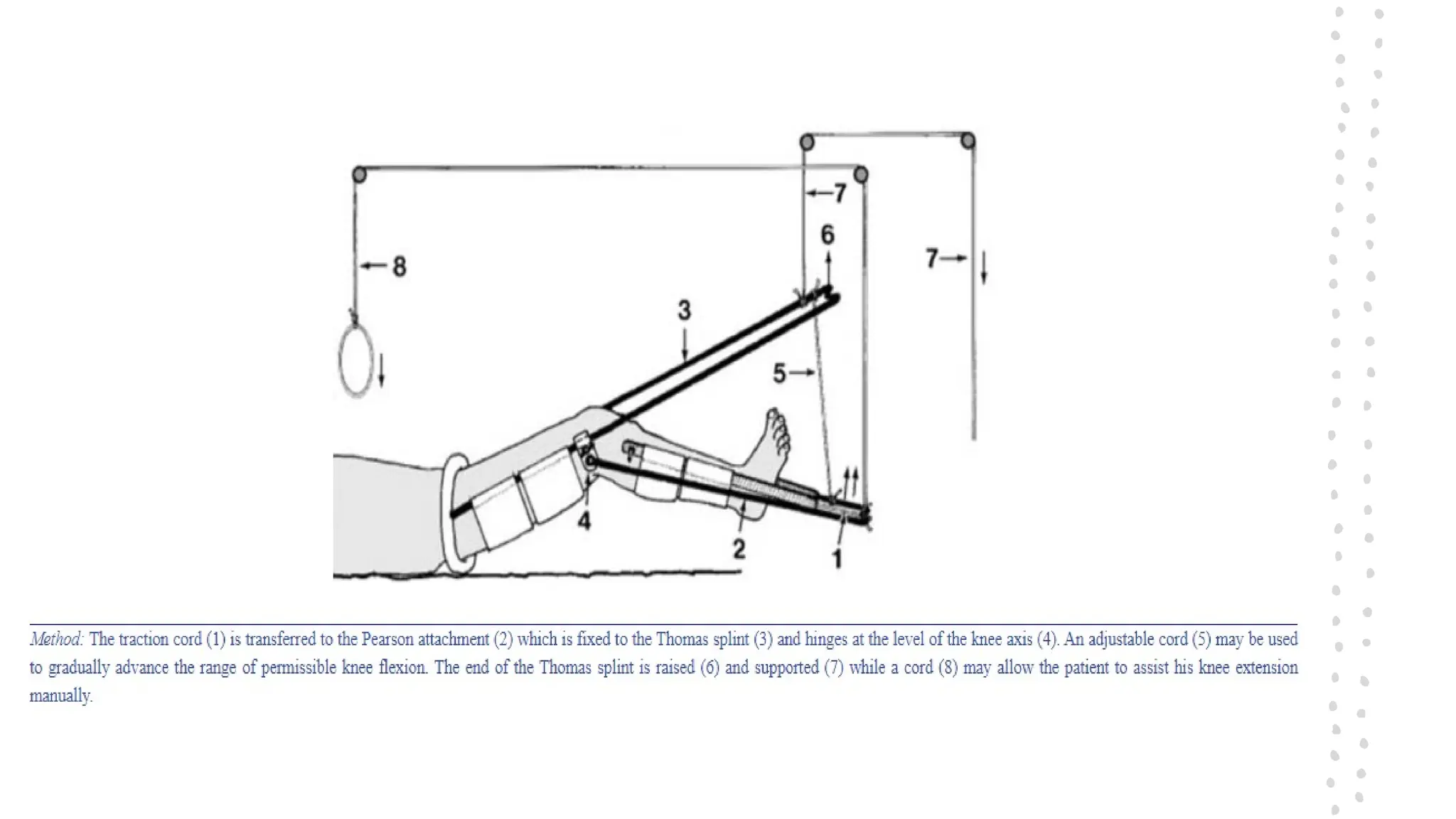 TRACTION.pptx orthopedics lecture series | PPT