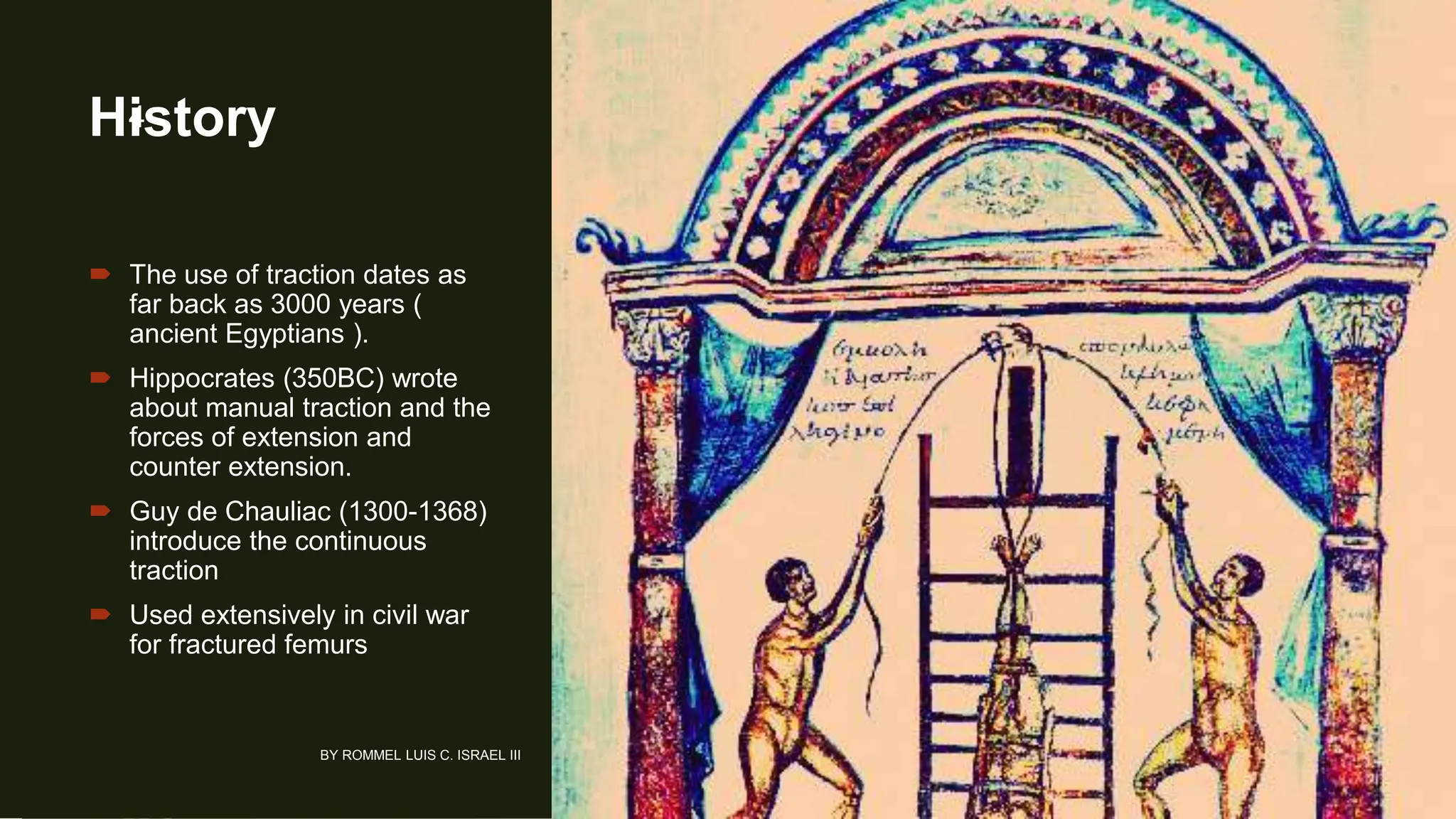 Traction In Orthopedics | PPTX