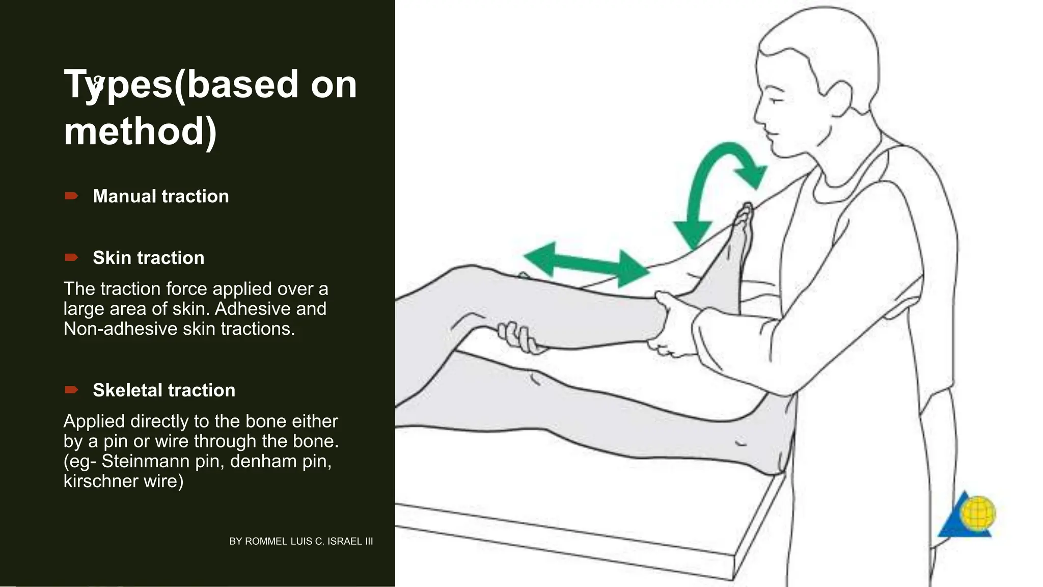 Traction In Orthopedics | PPTX