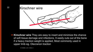 Traction In Orthopedics | PPTX