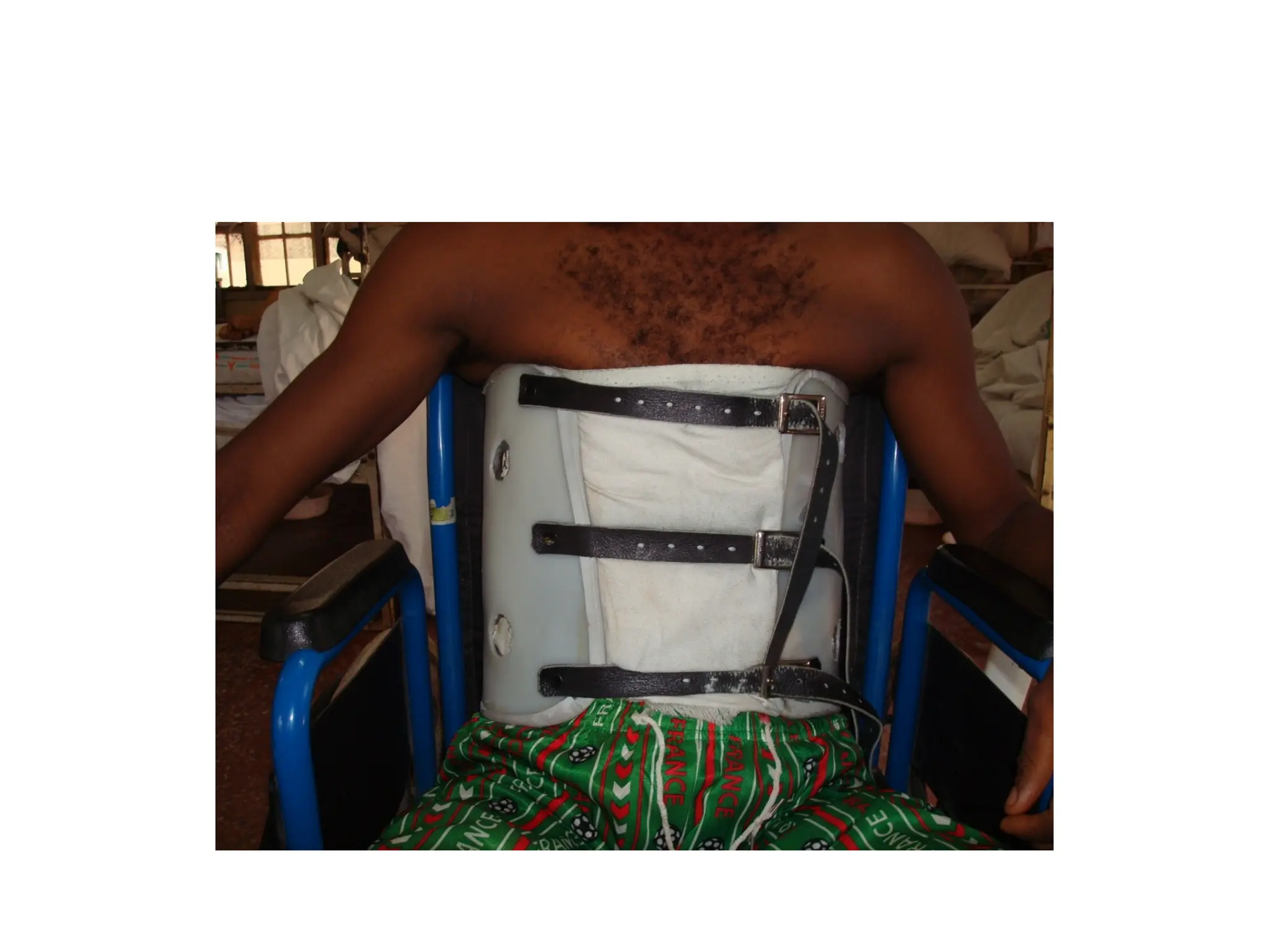 TRACTION AND SPLINTS IN ORTHOPAEDICS new.ppt