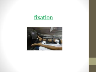 Traction ,cast and fixation | PPTX