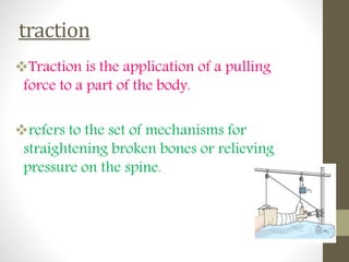 Traction ,cast and fixation | PPTX