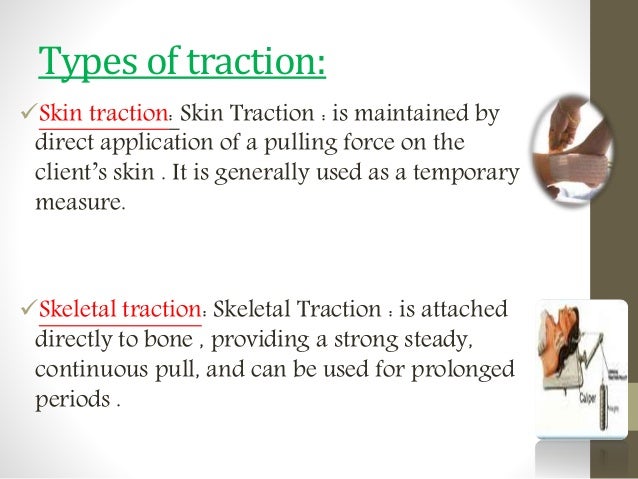 Skin Vs Skeletal Traction