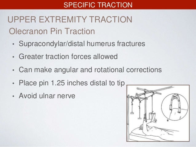Traction in orthopaedic