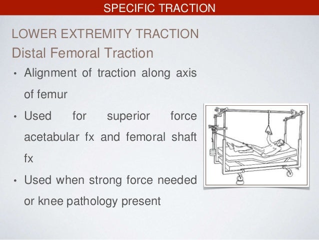 Traction in orthopaedic