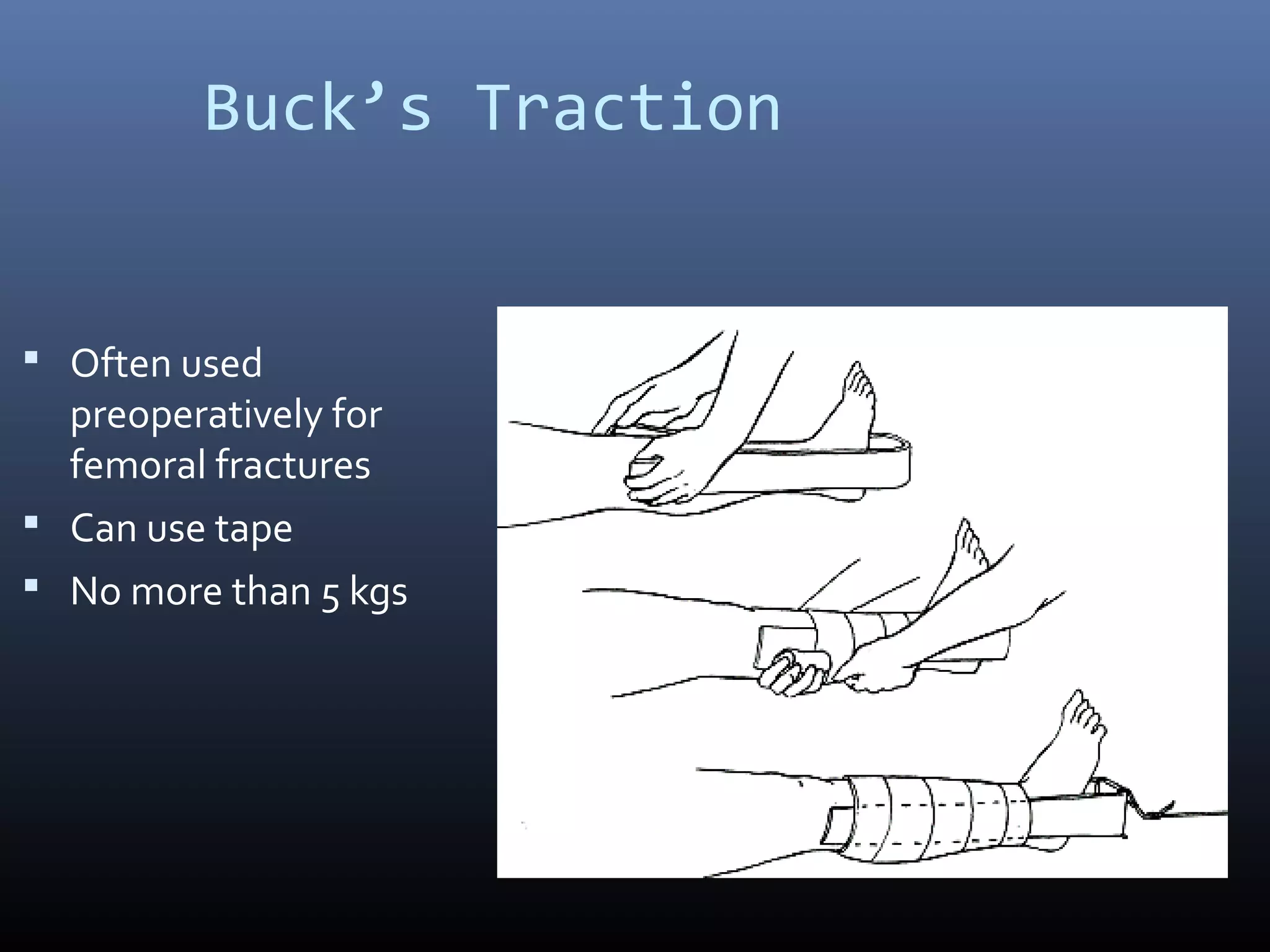 Traction in orthopaedics | PPT
