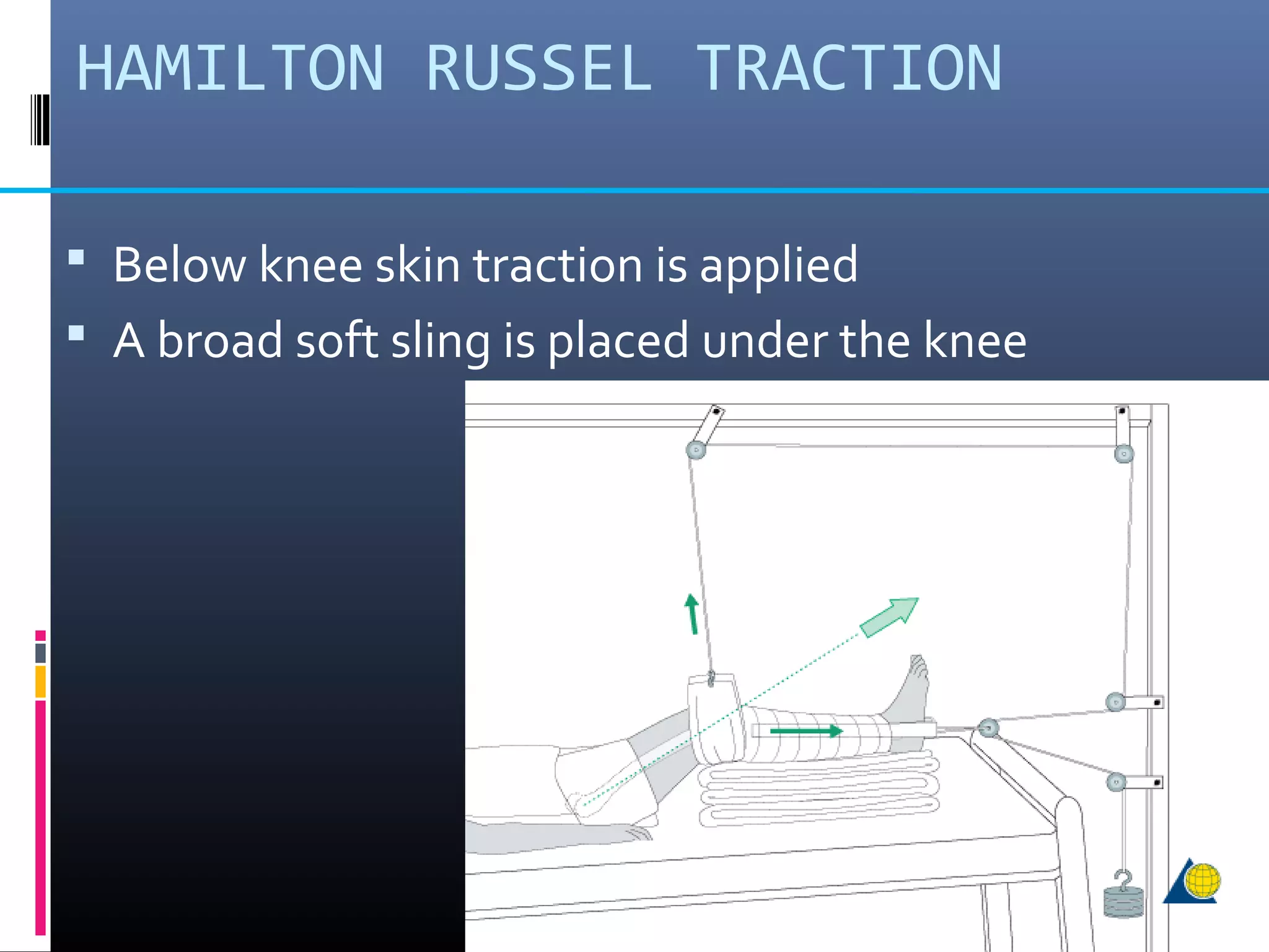 Traction in orthopaedics | PPT