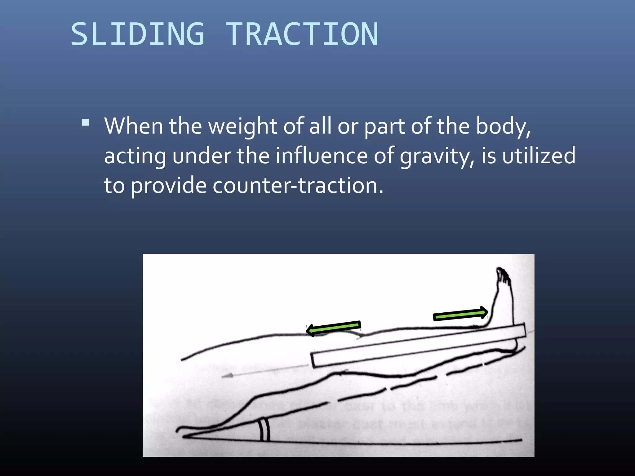 Traction in orthopaedics | PPT