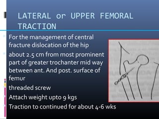 Traction in orthopaedics | PPT