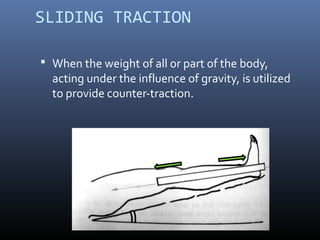 Traction in orthopaedics | PPT