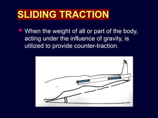 traction_in_orthopaedics new orthoapedics .pptx