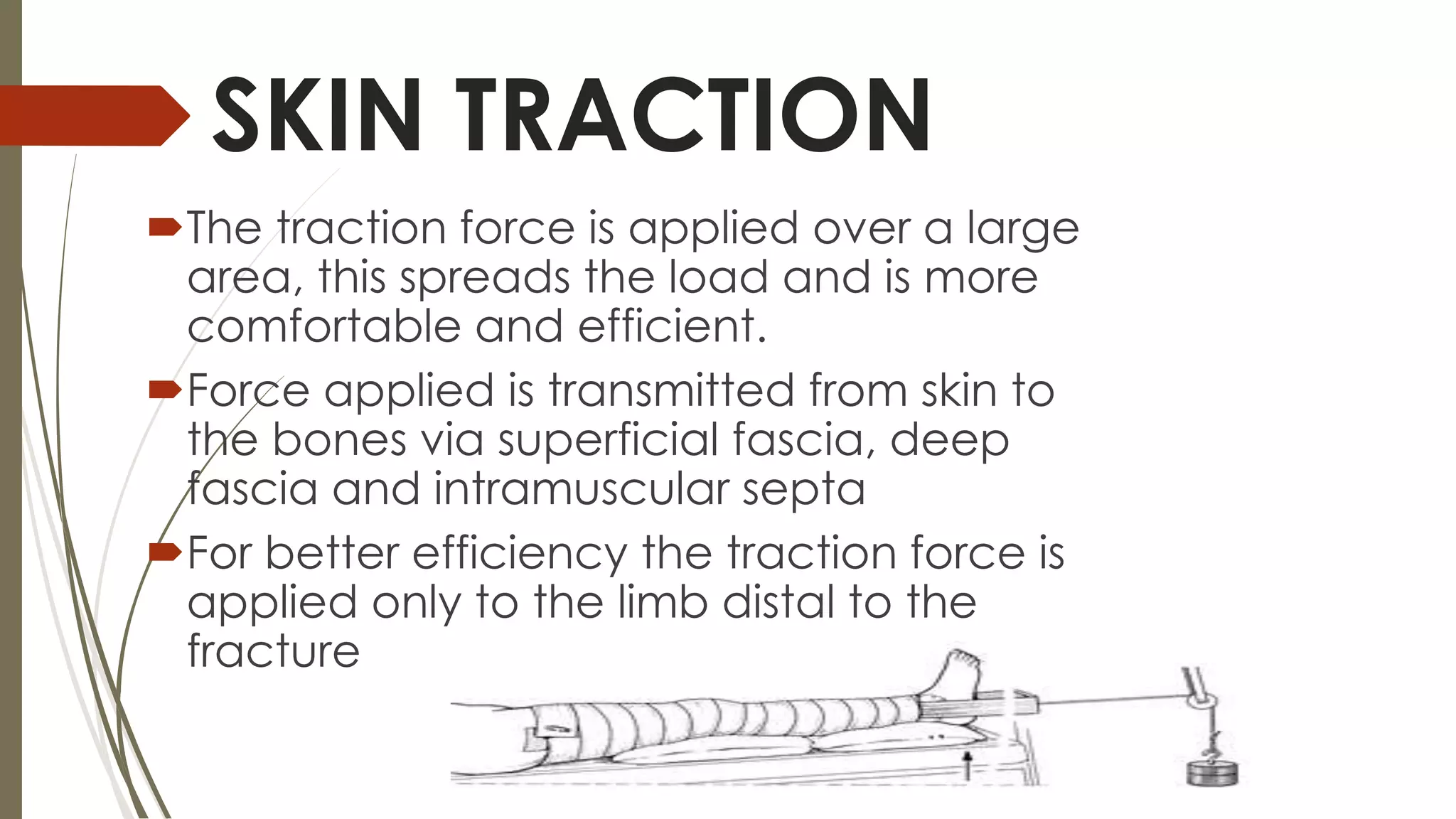 Traction(orthopedics) | PPTX
