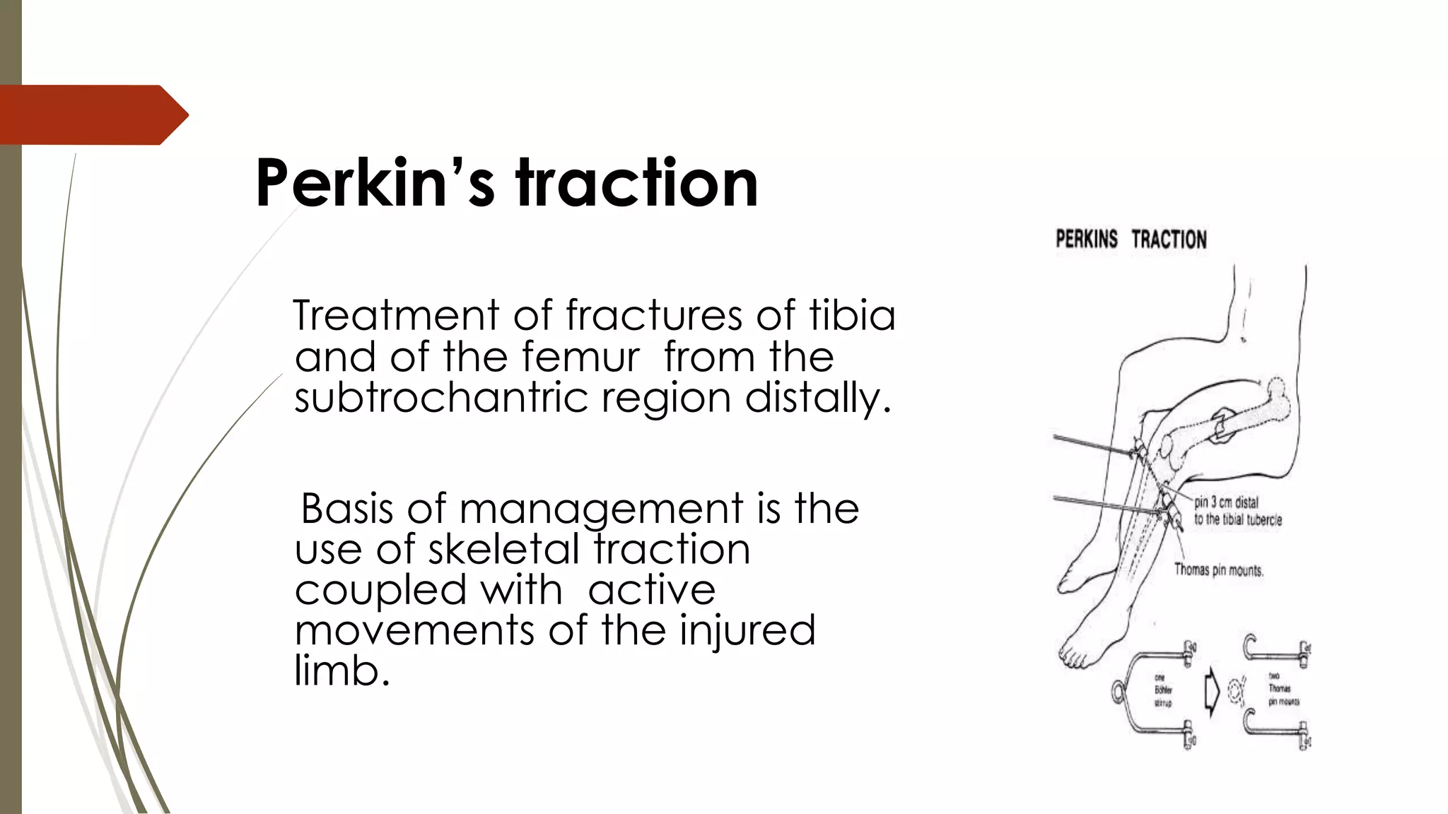 Traction(orthopedics) | PPTX