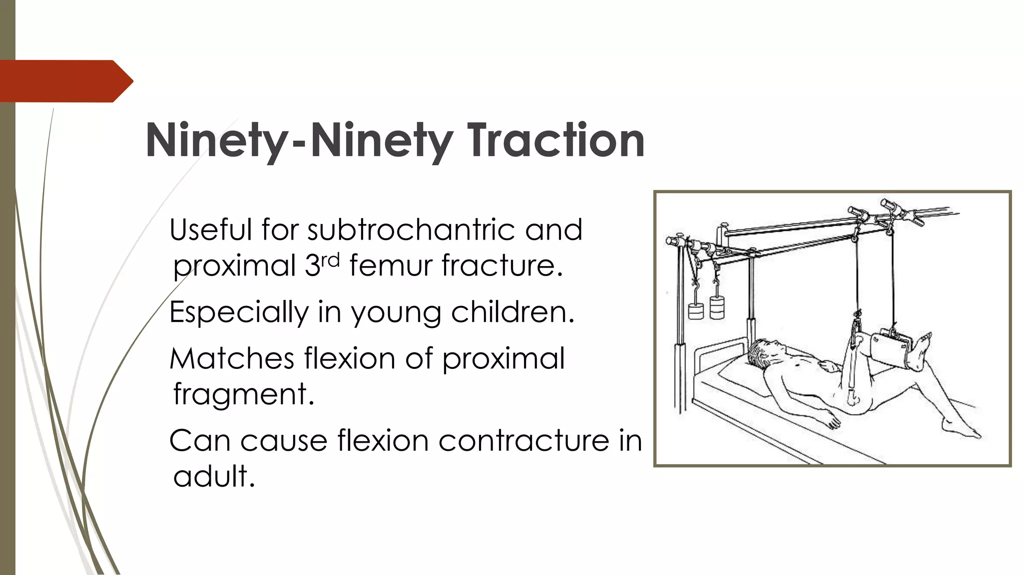 Traction(orthopedics) | PPTX