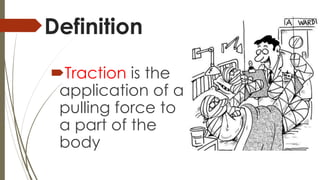 Traction(orthopedics) | PPTX