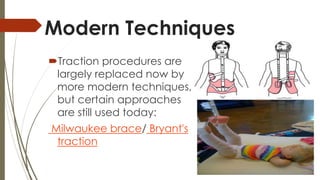 Traction(orthopedics) | PPTX