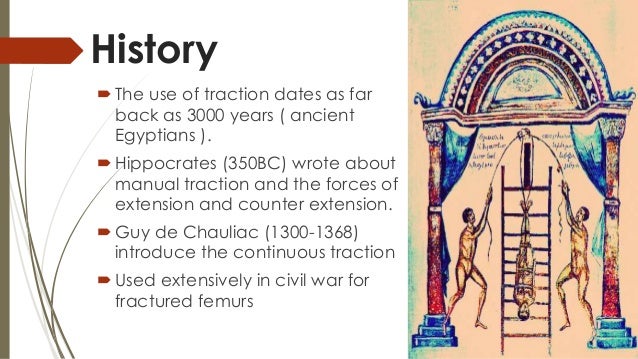 Traction(orthopedics)