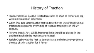 TRACTION IN ORTHOPEDICS By Dr Ango of orthopedic department ABUTH Zaria ...